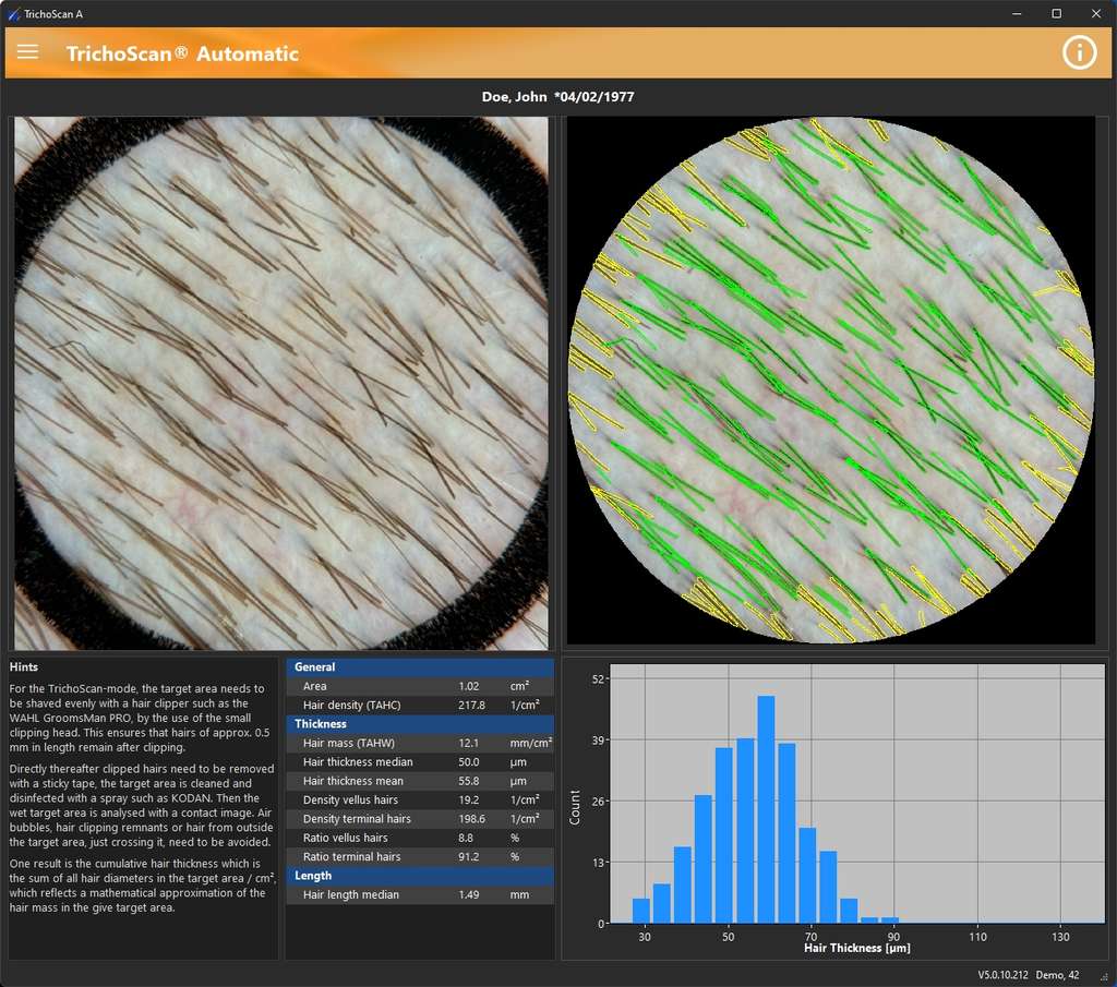 Home - trichoscan.com